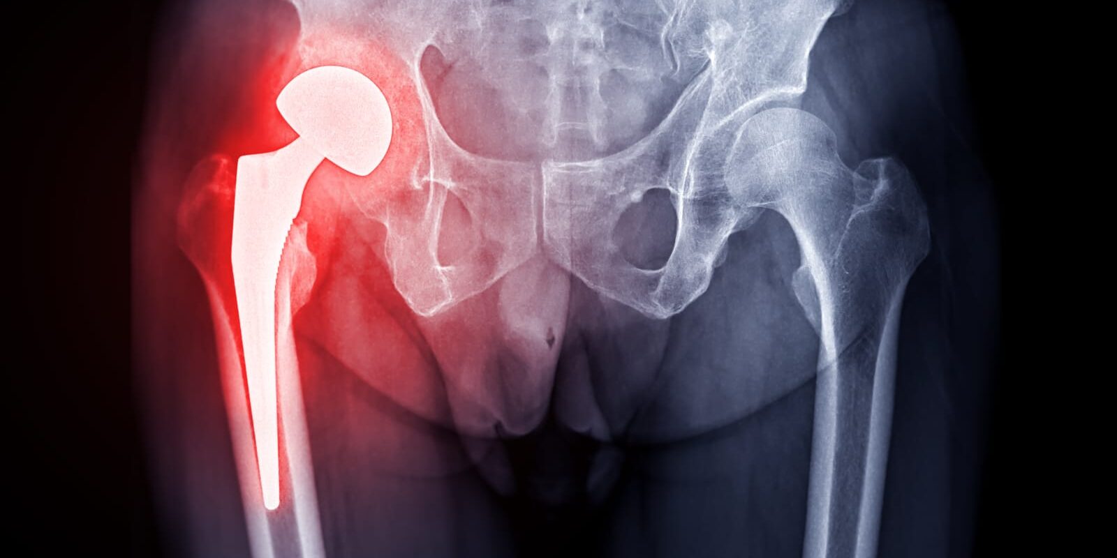 Orthopedie Apeldoorn - Orthopedie Apeldoorn