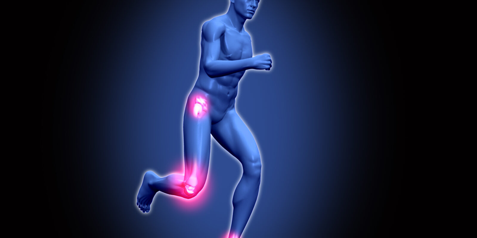 Orthopedie Apeldoorn - Orthopedie Apeldoorn